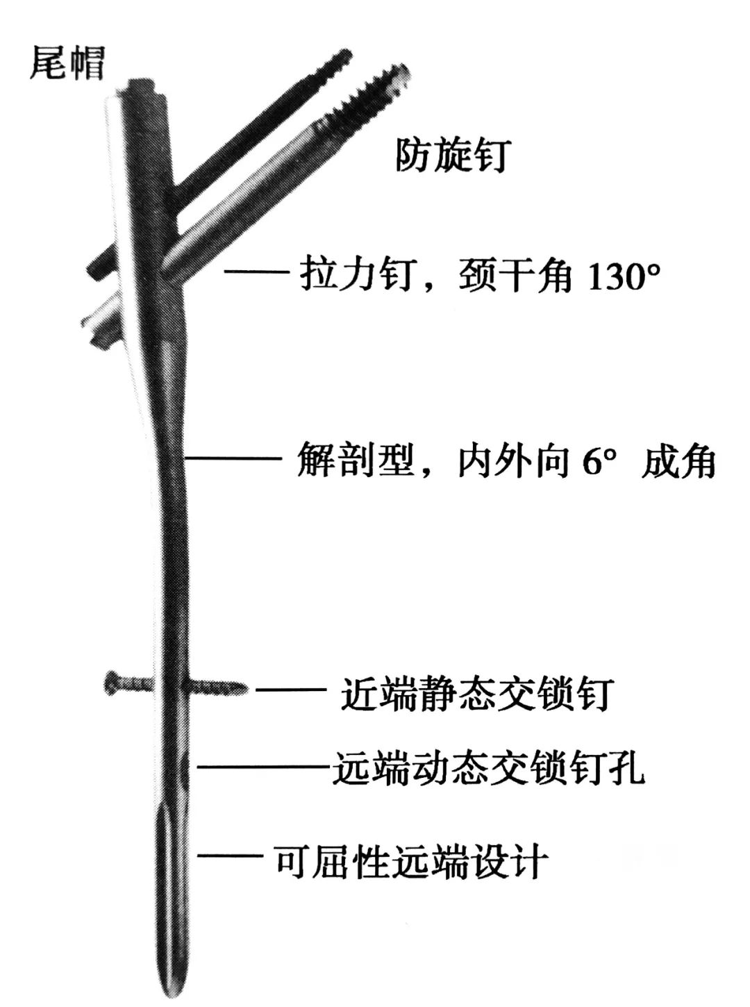打好髓内钉必备知识有这些 上海开为医药科技有限公司 创伤肢体矫形技术解决方案的专业服务商