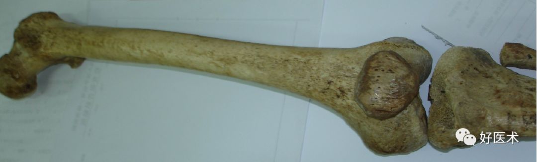 早读 | 骨科基本操作技术汇总，值得收藏备用！ - 上海开为医药科技有限公司--创伤、肢体矫形技术解决方案的专业服务商